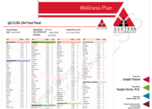 DEXA | RMR | VO2 | Nutrition Services | Live Lean Rx Houston